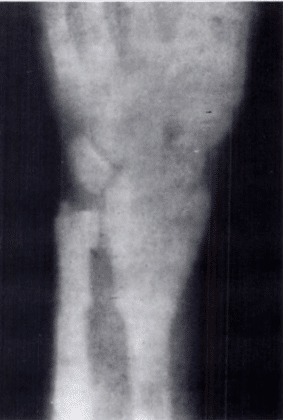 First ever X-ray in the US was performed on the invention of Ukrainian ...